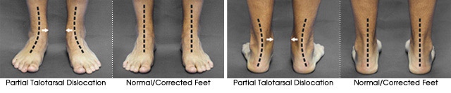 HyproCure/Foot Care in Fuquay Varina & Sanford, NC | Carolina Family ...