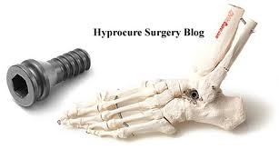 HyproCure/Foot Care in Fuquay Varina & Sanford, NC | Carolina Family ...